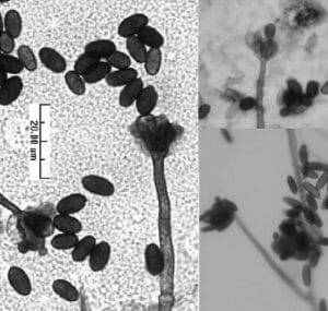 La muffa nera che fa ammalare : Stachybotrys chartarum